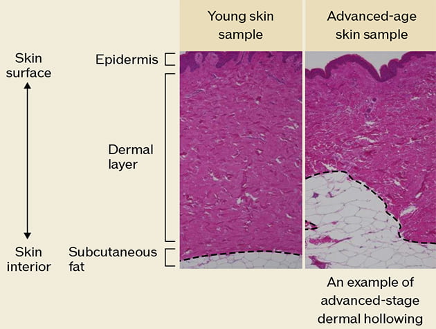lp-vital-perfection-research